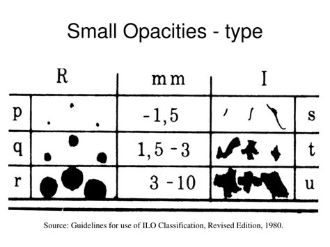 Ppt An Introduction To The Ilo Radiological Classification Of The