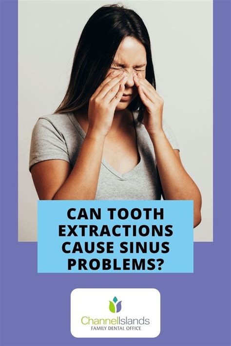 Tooth Extraction Sinus Headache At Harrison Fitch Blog