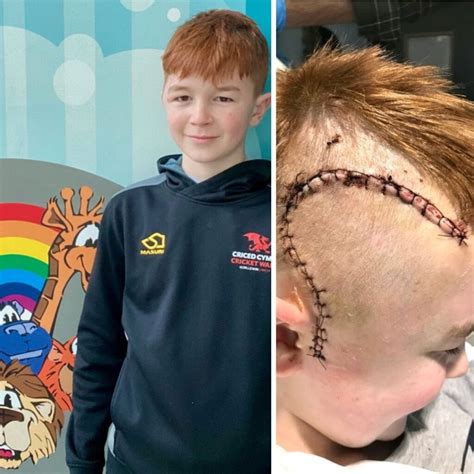 Carten100 2026 Carten100