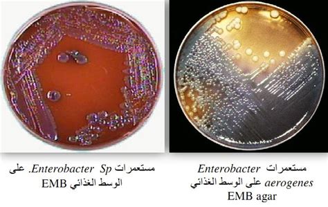 Enterobacter Cloacae Emb