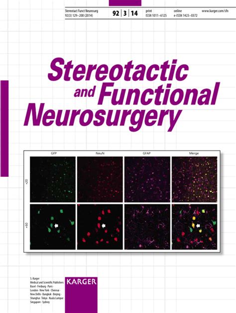 Spinal Accessory Neuropathy Following Dual Tunneling Of Lead Extensions