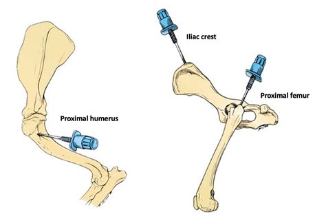 Demystifying Bone Marrow By Eric Fish Dvm Phd