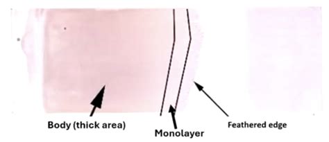 Hemolymphatic Infections Flashcards Quizlet