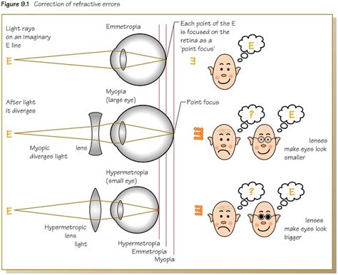 Olver Ophthalmology At A Glance