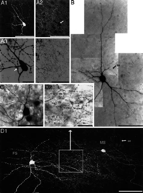 The Morphology Of Cultured Striatal Fs Interneurons A1 Striatal Fs Download Scientific