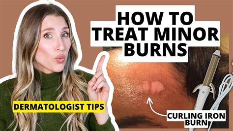 Dermatologist Explains How To Treat Minor Burns And Minimize Scarring Dr Sam Ellis Youtube