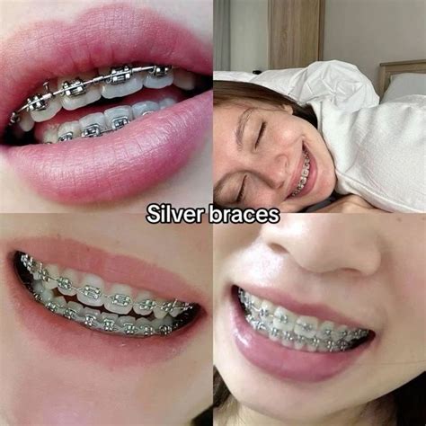 Pin By Annahh🧸 On Pins By You In 2024 Perfect Teeth Perfect Teeth