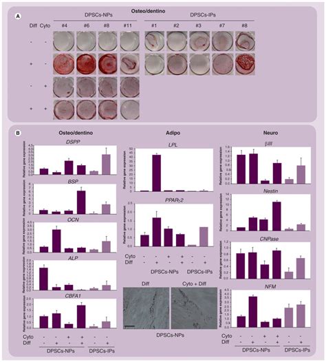 Differentiation Induction Analysis Dpsc Np Or Dpsc Ip Cultures From