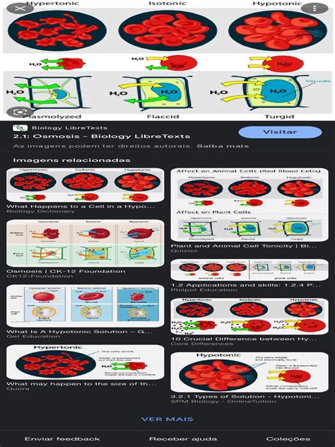 General Cell In A Hypotonic Environment And One In A Hypotonic
