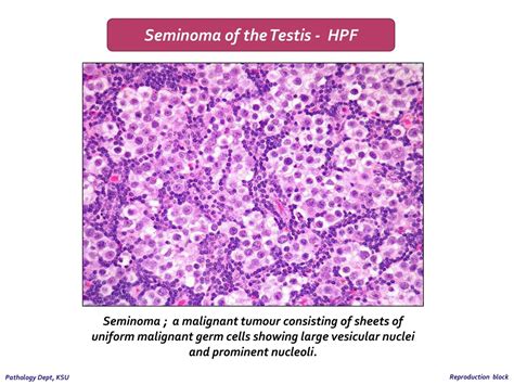 Ppt Reproduction Block Pathology Practicals Powerpoint Presentation