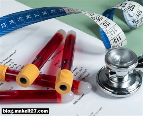 의학용어 Cmp Iv Kvo 블로그잇27