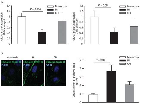 Increased Internalization Of Complement Inhibitor Cd59 May Contribute