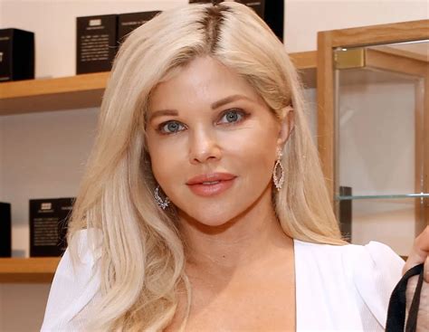 Donna Derricos Journey Arm Lift Tummy Tuck And Plastic Surgery