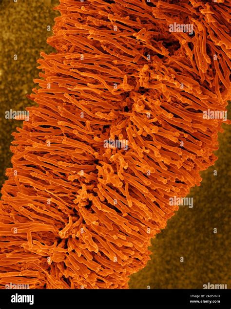 Coloured Scanning Electron Micrograph Sem Of The Bracket Fungus