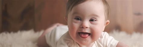 Down Syndrome Symptoms Explained Padham Health News