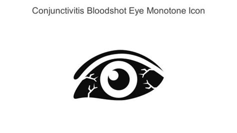Conjunctivitis Powerpoint Presentation And Slides Ppt Template Slideteam