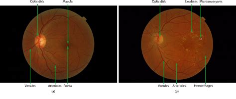 Figure 1 From University Of Dundee A Review Of Machine Learning Methods