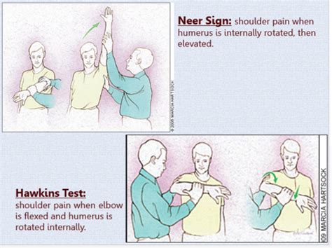 Shoulder Fcp Iii Exam 2 Flashcards Quizlet