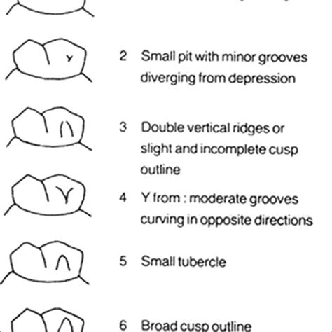 Bilateral Or Unilateral Occurrence Of Carabelli Trait Download Table