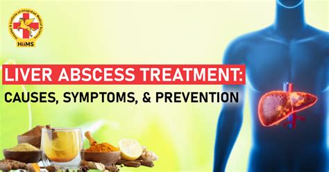 Effective Liver Abscess Treatment Options Symptoms And Recovery