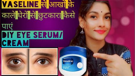 Dark Circles Under Eyes Vaseline At Ralph Livingston Blog