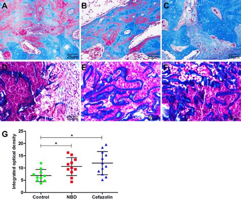 Assesment Of New Bone Tibia Defects Using Masson Staining In The