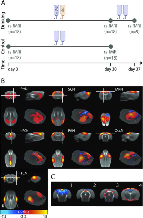 Experimental Rs Fmri Design And Rsns Obtained With Group Pica A Download Scientific Diagram