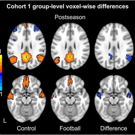 Region‐of‐interest Functional Connectivity Grouped Bar Plots