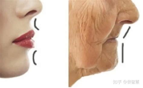 私密部位与面部一样，也会凹陷干瘪？ 知乎