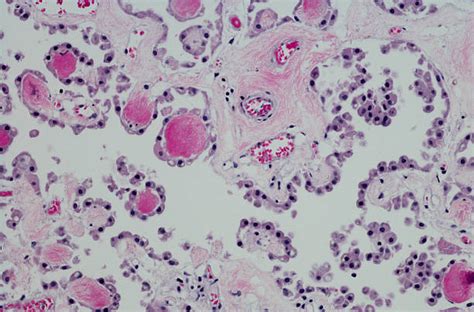 180 Kubisch Epitheel Stockfotos Afbeeldingen En Royalty Free Beelden