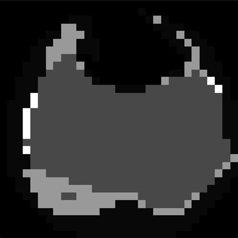Segmented Lung Map Composed By Three Regions Dark Gray Perfusion And