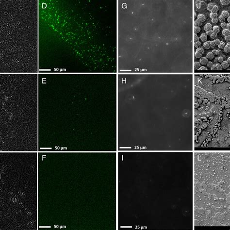 Standard Gbs Gbs Positive And Gbs Negative Clinical Samples Imaged By