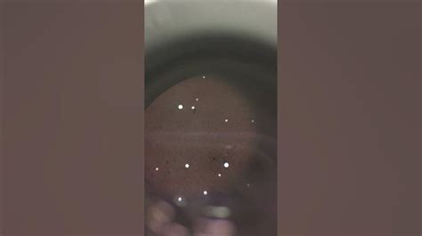 Tinta Da China Pesquisa De Cryptococcus Spp Positiva Youtube