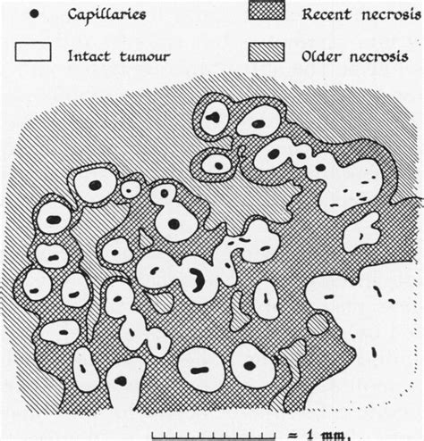 A Diagrammatic Map Of Tissue In The Intermediate Zone As Shown In Fig