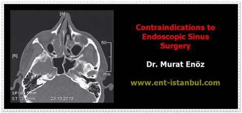 Endoscopic Sinus Surgery