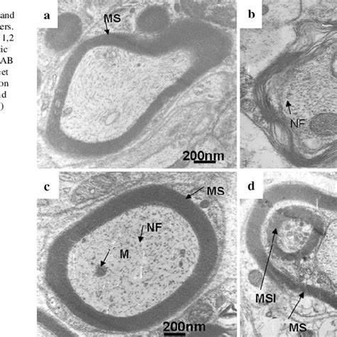 Ultrastructural Microscopy Of Sciatic Nerve And Spinal Cord Myelin