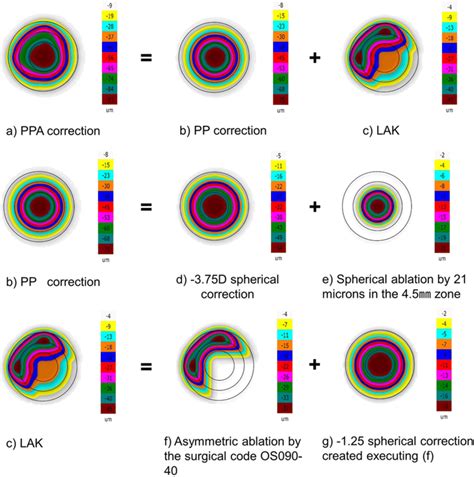 Actual Simulations Of Laser Ablation Patterns For Ppa Execution On