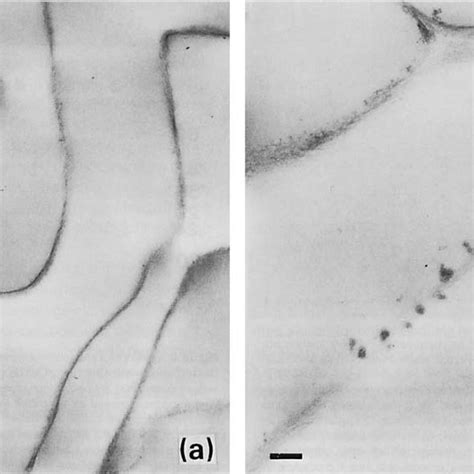 Transmitting Electron Micrograph Of Thin Sections Of Cell Wall Download Scientific Diagram