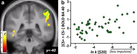 Patient Choice Less Impulsive And Correlated Activation To Csa