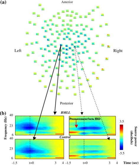 A Scalp Topography Of Grand Mean Source Power Maps B Grand Mean