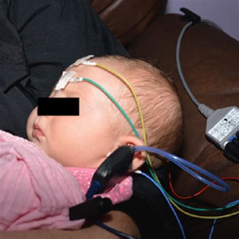 Infant Undergoing Unsedated Natural Sleep Auditory Brain Stem Testing Download Scientific