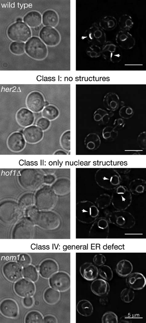 Full Length Active Hmg2p S Causes A Growth Defect In Strains Deficient