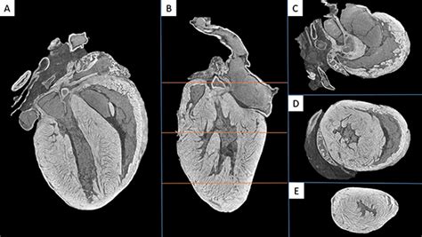Micro Ct Imaging Gallery School Of Dentistry