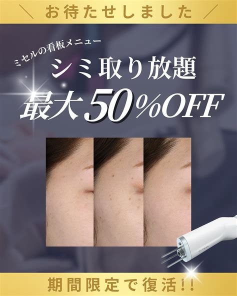 ミセルクリニック大阪梅田院🏥美容皮膚科•外科 【お得な通える方法11選📕】 ミセルに通ってくださっている方は もうご存知の方も多いと思いますが、 実は知らない情報があるかも？！ 年間で