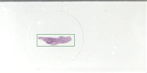 Swollen Sciatic Nerve Whole Slide Image Viewer Uscopehxii 20x 065na