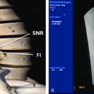 Ultrasonography Of Blocks And Positions Of Transducer A Identify The