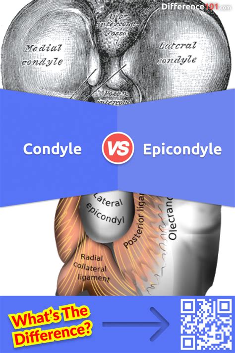 Condyle Vs Epicondyle 4 Key Differences Examples Pros And Cons