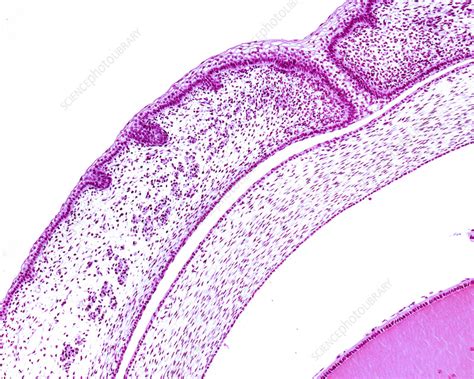 Developing Eye Light Micrograph Stock Image C0595420 Science