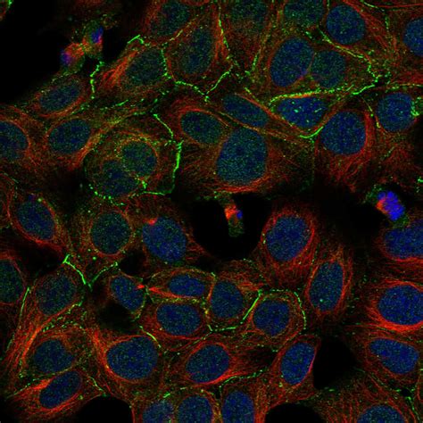 Subcellular Cdh6 The Human Protein Atlas