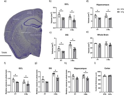 Early Postnatal Defects In Neurogenesis In The 3xtg Mouse Model Of